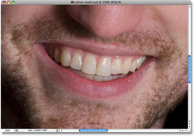 Whiten And Brighten Teeth In Photoshop